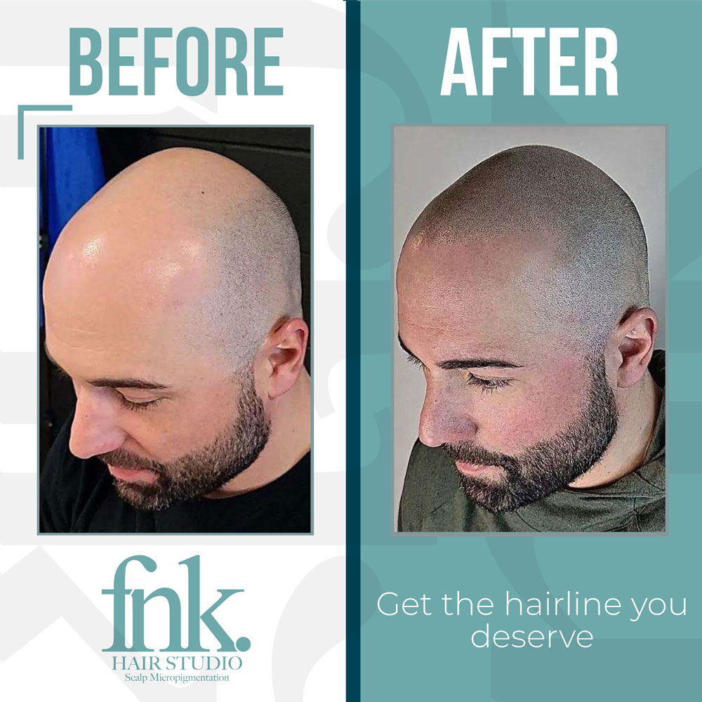 Hair Tattoo Before and After - FNK Hair Studio